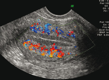 Get Specialized Ultrasounds Infertility Scan in Ahmedabad